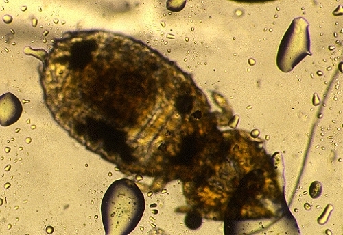 Phtiriose