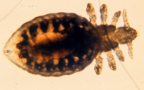Linognathus setosus