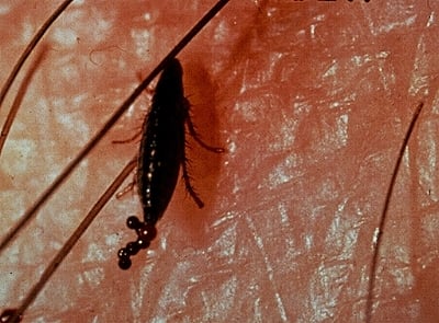 Pulicose
